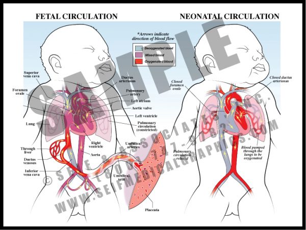 Fetal/Neonatal Circulation - S&A Medical Graphics