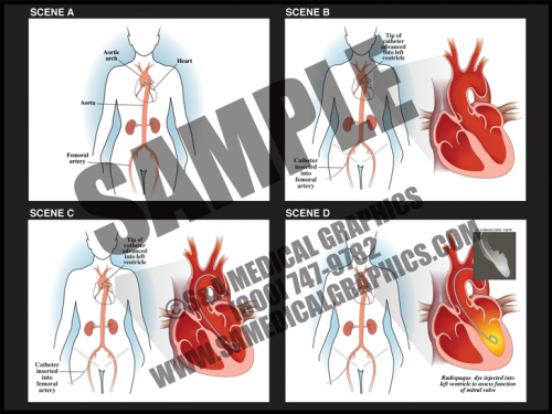 Stock Medical Exhibit Store - S&A Medical Graphics
