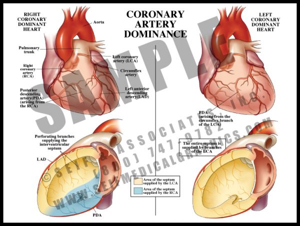 Coronary Artery Anatomy - S&A Medical Graphics