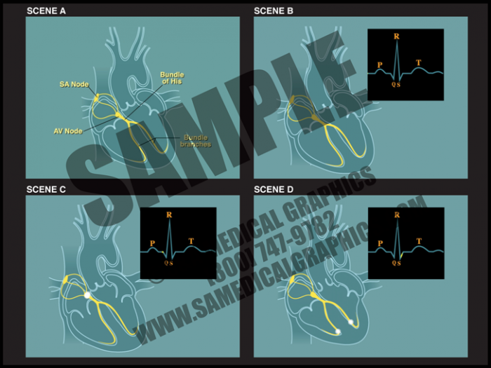 Normal Heart Anatomy - S&A Medical Graphics