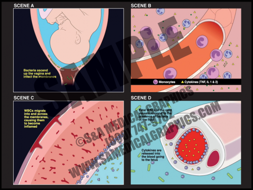 Stock Medical Exhibit Store - S&A Medical Graphics