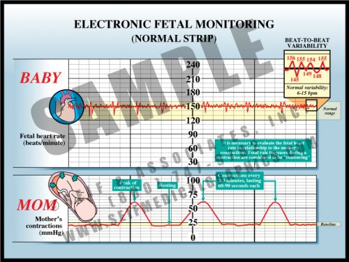 Cervical Anatomy - S&A Medical Graphics