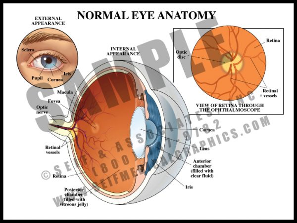 Visual Field Defects - S&A Medical Graphics