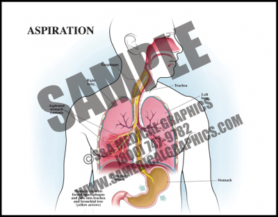 Anatomy of Respiration - S&A Medical Graphics