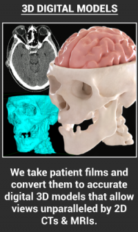 3D Digital Models & 3D Printing - S&A Medical Graphics