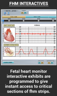 Interactive Fetal Heart Monitor Strip - S&A Medical Graphics
