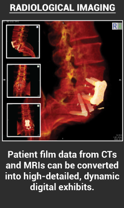 S&A Medical Graphics - Medical Illustrations | Animations | Exhibits