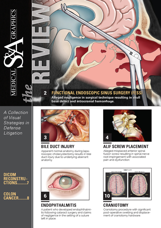 Case Study Newsletters - S&A Medical Graphics